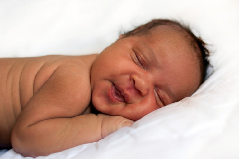 Is Your Newborn’s Appearance Normal? – Lisa Lewis, MD